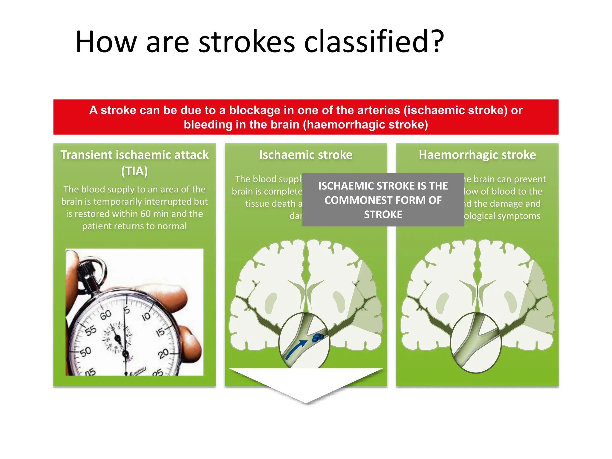 Acute thrombolysis in Stroke PPT Dr Jankar copy. | PPTX