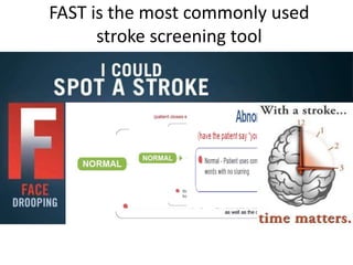 Acute thrombolysis in Stroke PPT Dr Jankar copy. | PPTX