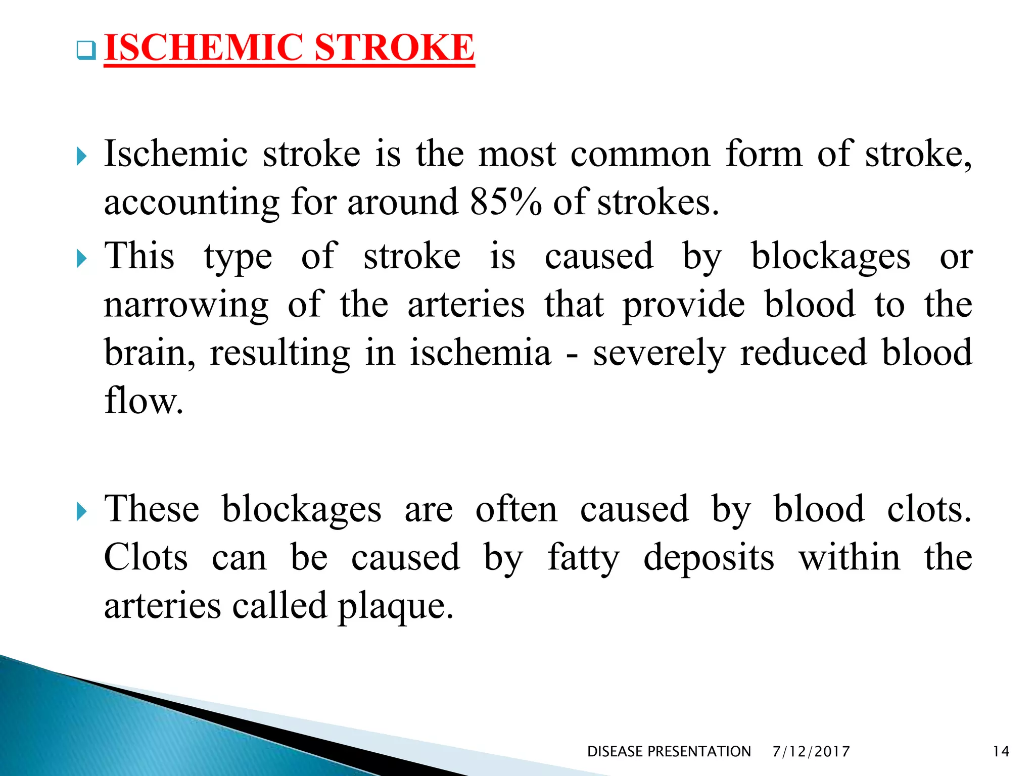 Stroke presentation | PPTX