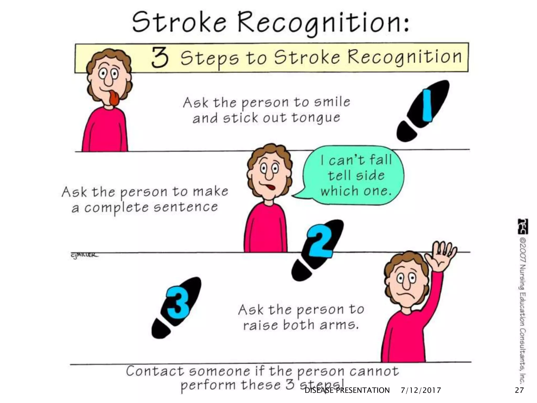 Stroke presentation | PPTX