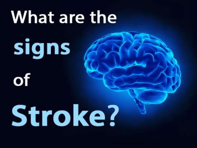 Stroke presentation | PPTX | Brain and Nervous System Disorders ...