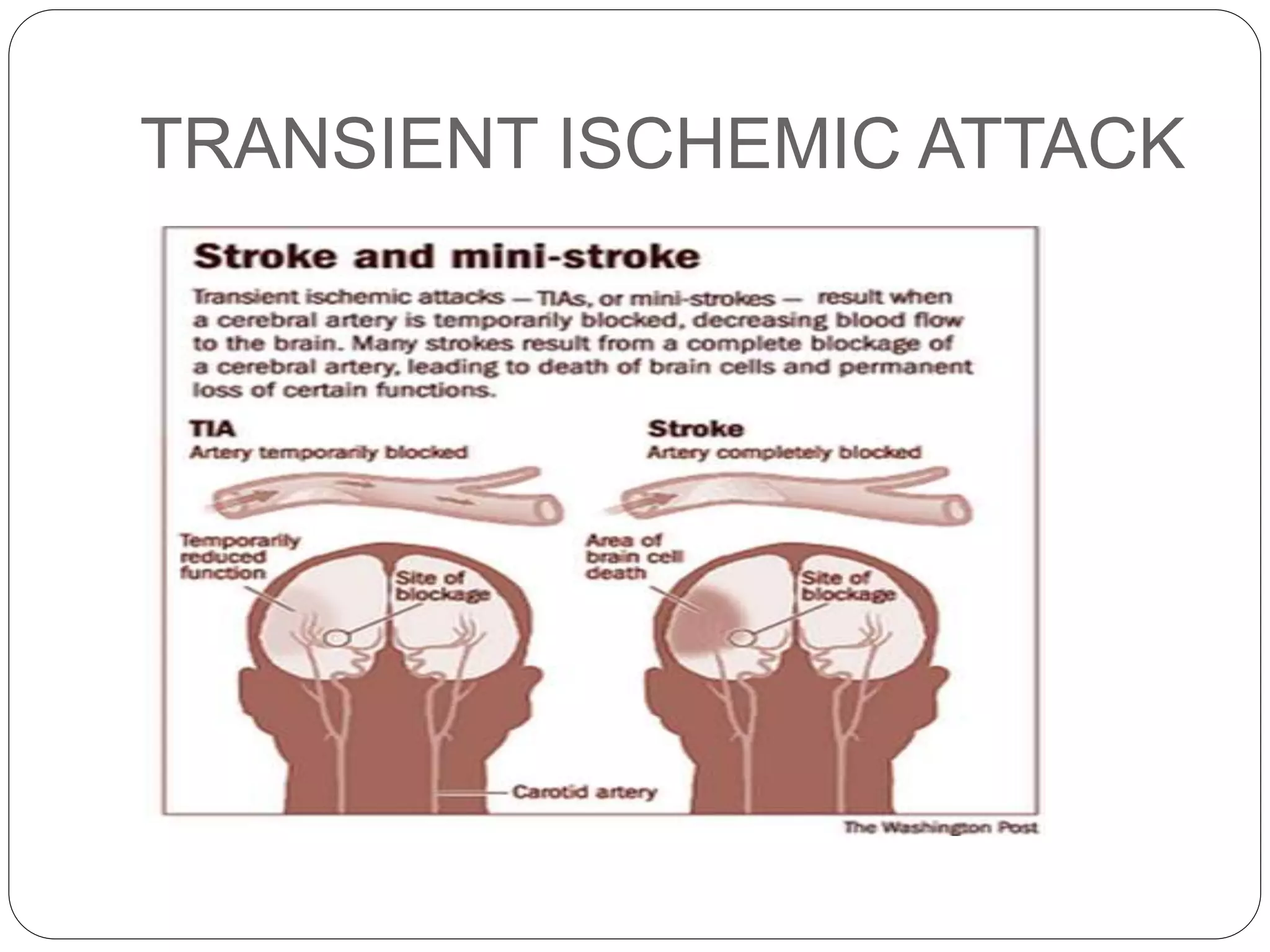 Stroke presentation By Saba Arif | PPT