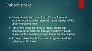 Stroke | PPTX