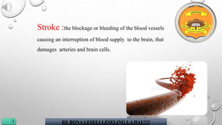 STROKE PRESENTATION.pptx