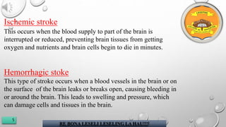 STROKE PRESENTATION.pptx
