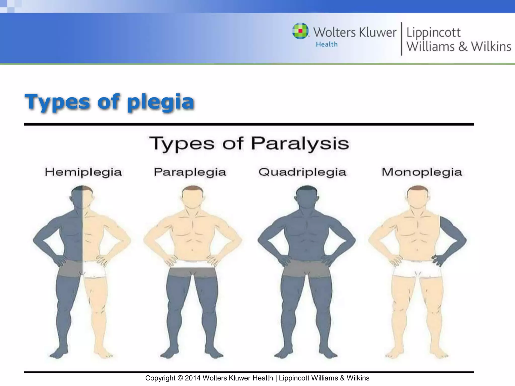 stroke presentation.ppt