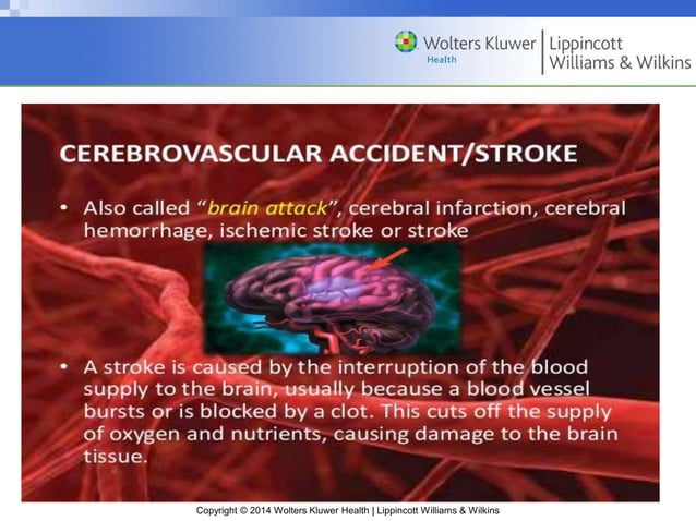 stroke presentation.ppt | Brain and Nervous System Disorders | Diseases ...
