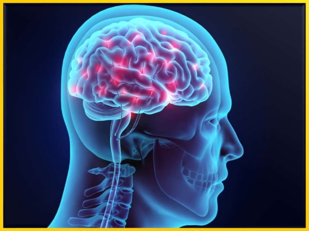 Stroke preventable and curable medicine jobelyn | PPTX