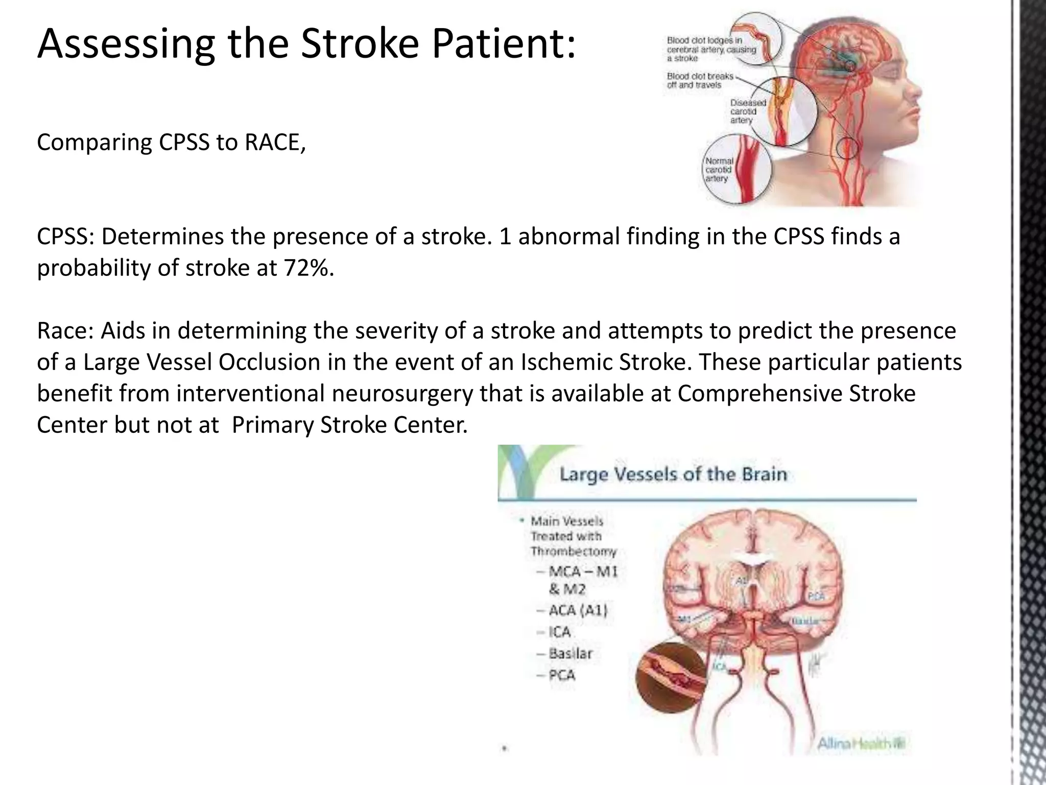 Stroke protocol update january 2017 | PPTX