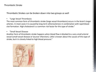 Stroke protocol update january 2017 | PPTX