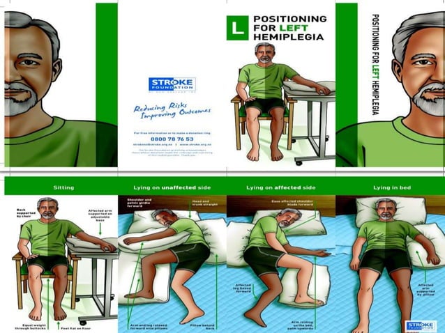 PHYSIOTHERAPY MANAGEMENT OF POST STROKE PATIENT. | PPTX
