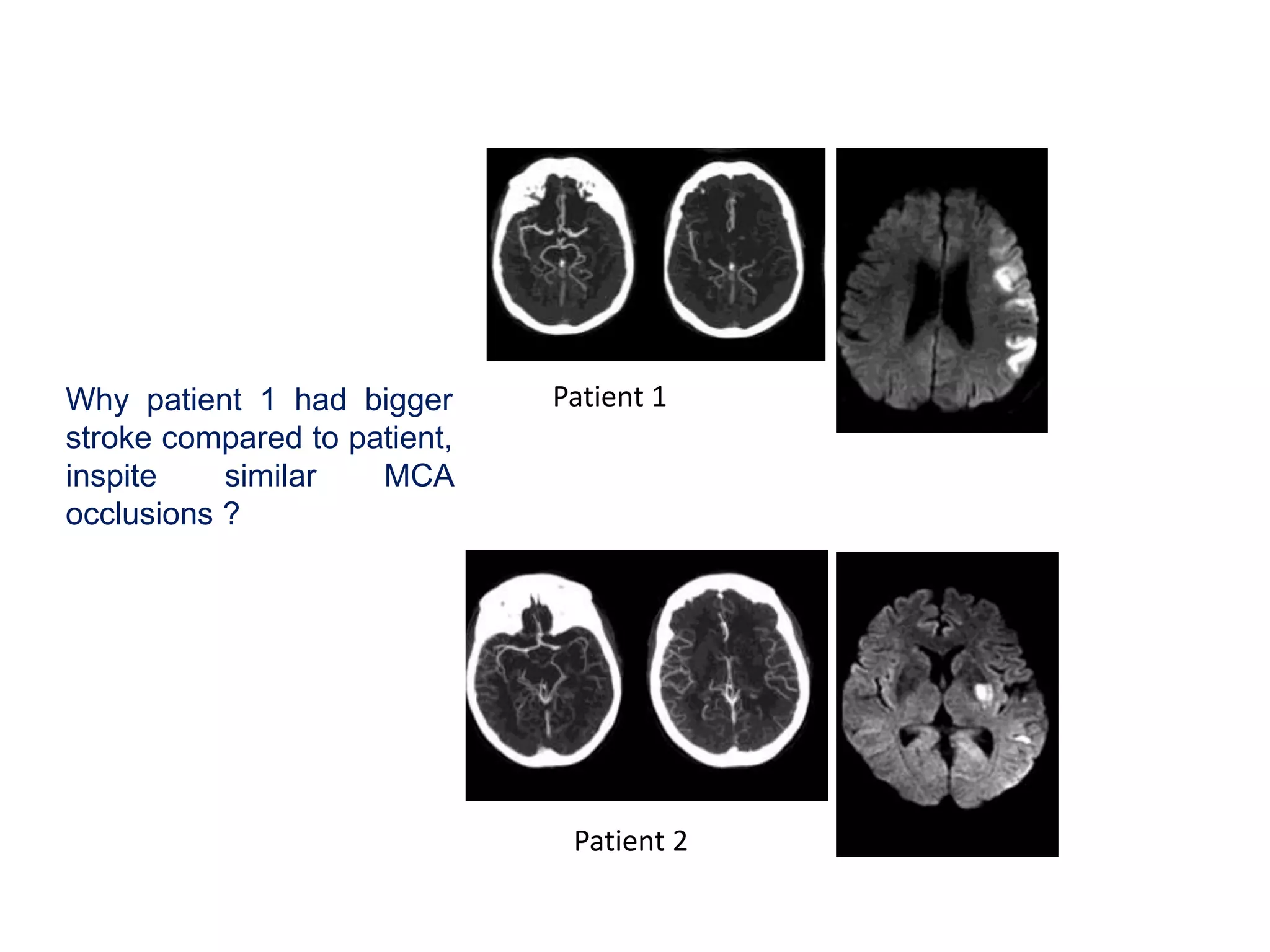 stroke quiz.pptx
