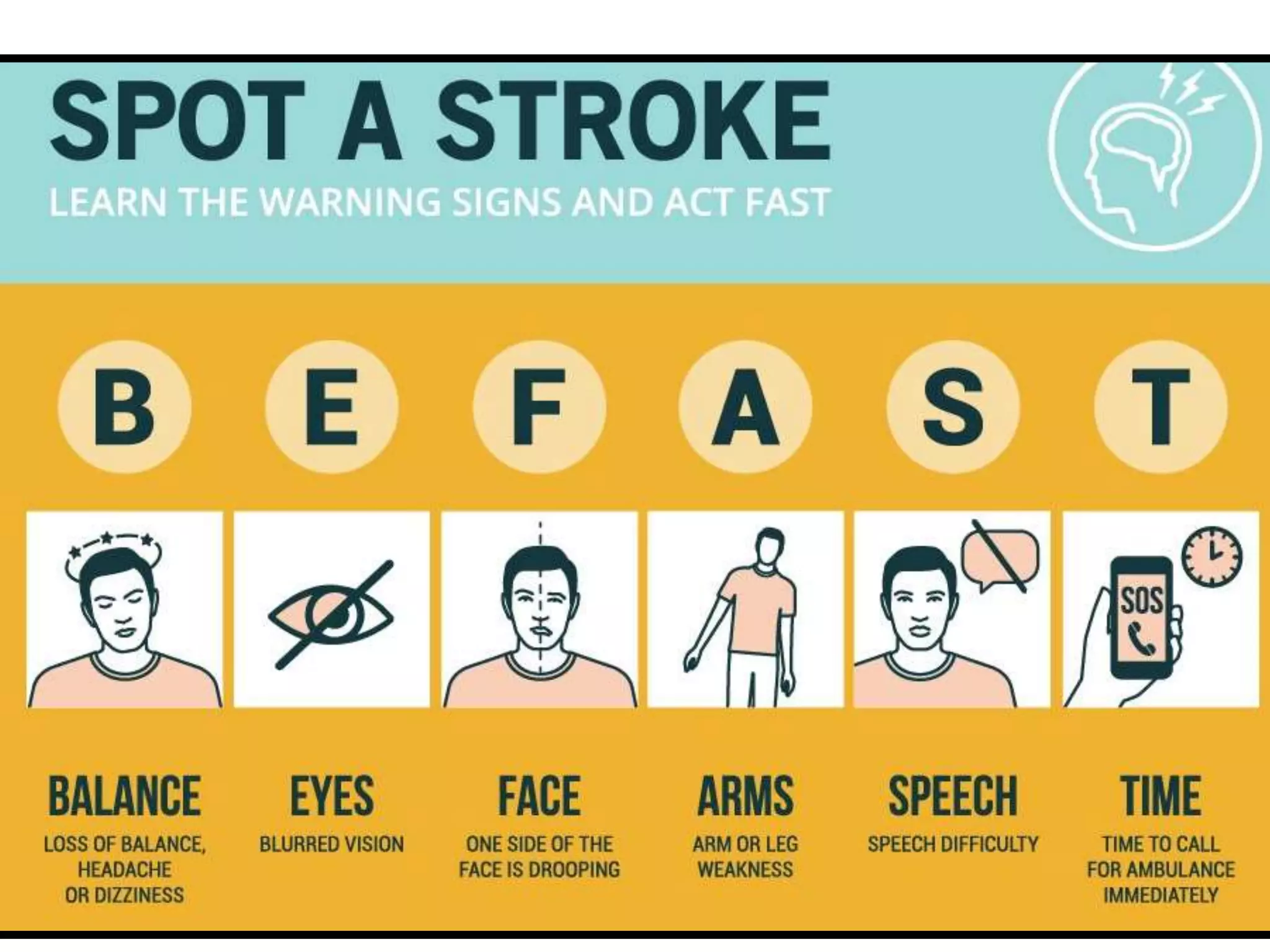 stroke quiz.pptx