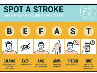 stroke quiz.pptx