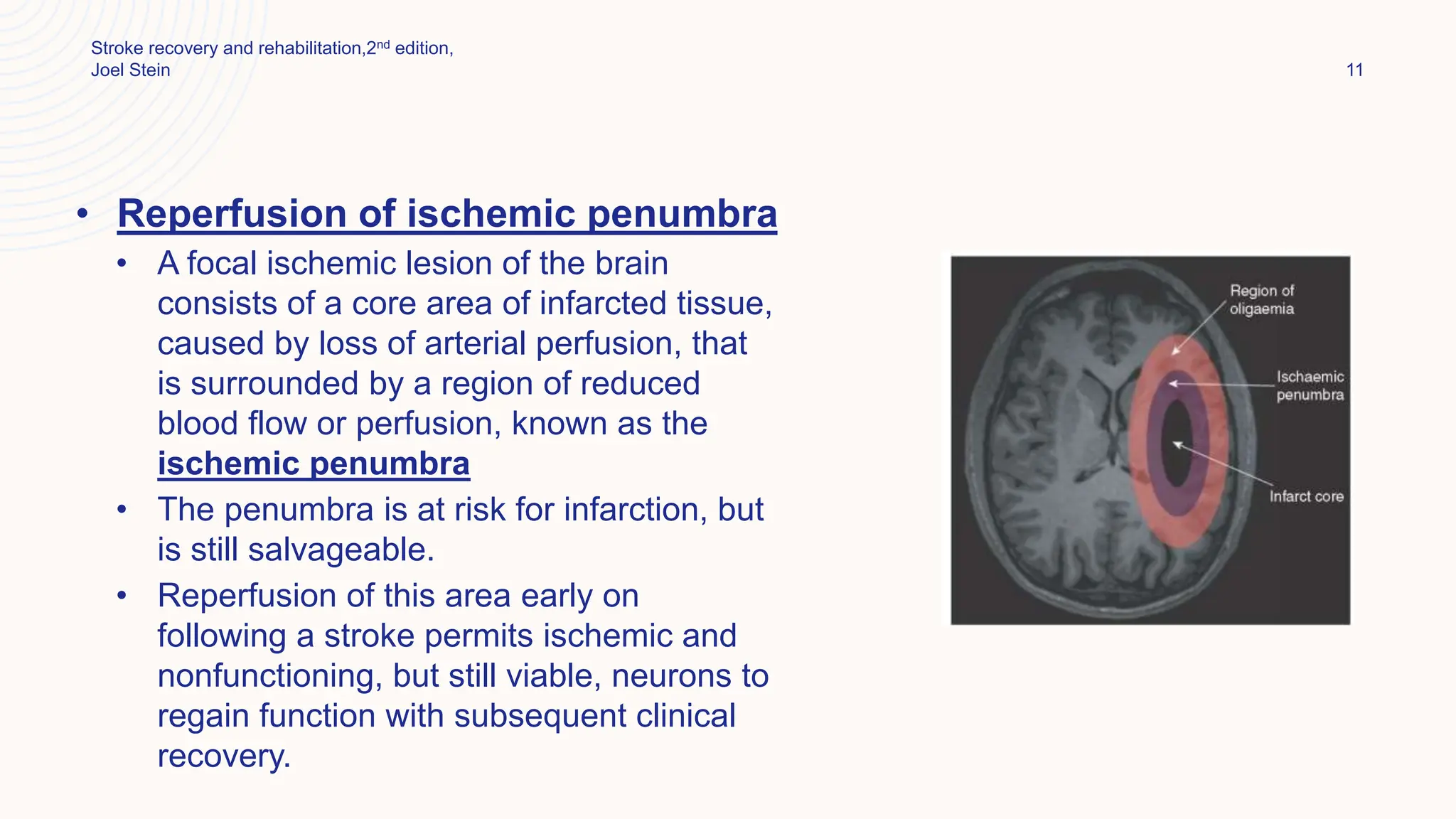 Stroke rehabilitation | PPTX