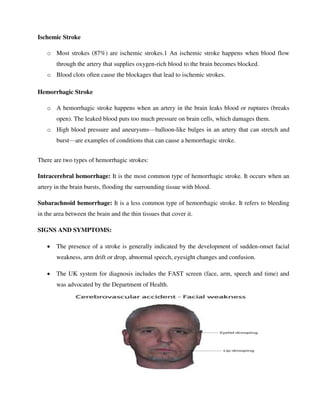 @ Stroke seminar | PDF