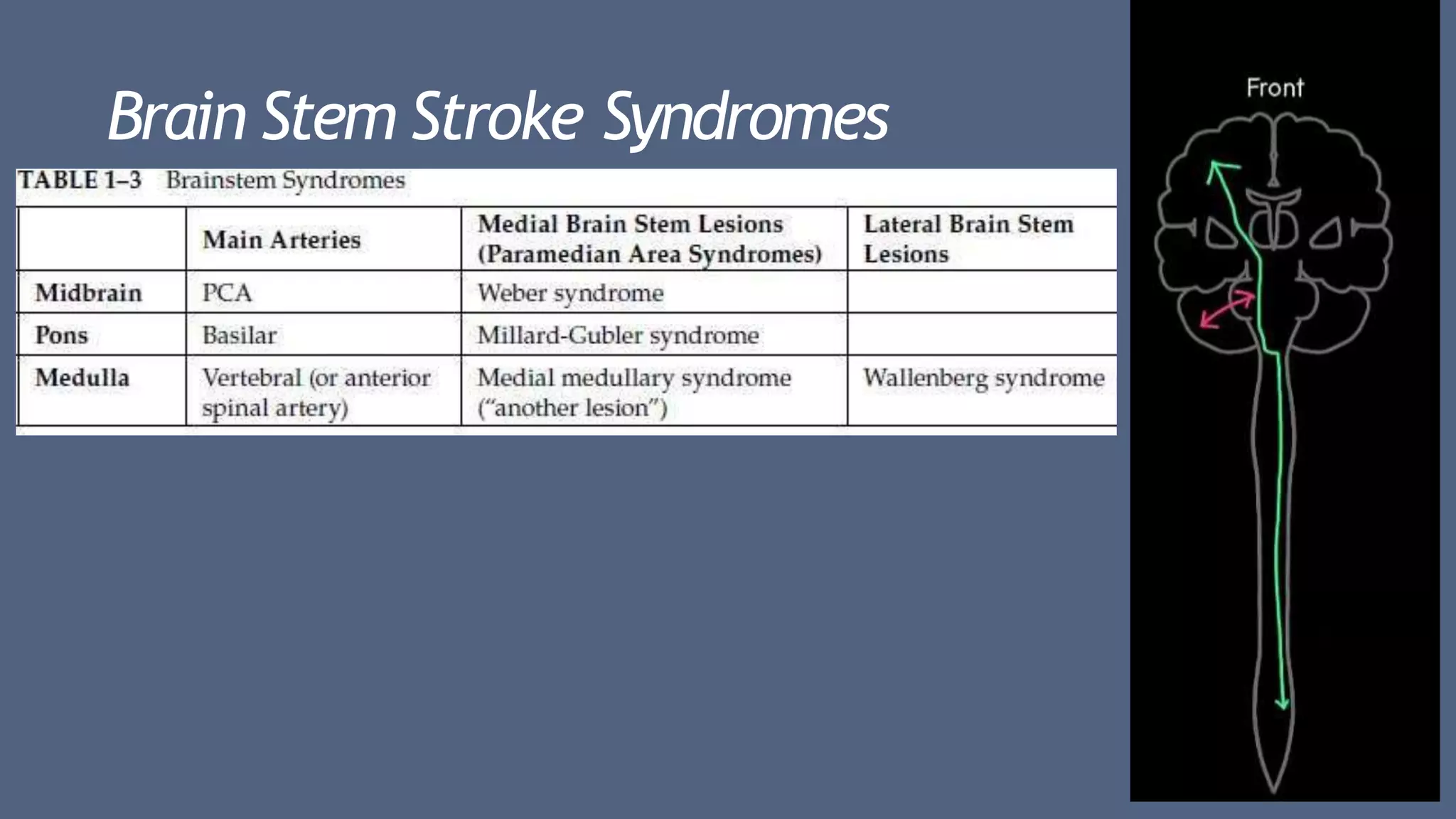 Strokesyndromes By Dr Shyam sunder Sharma | PPTX
