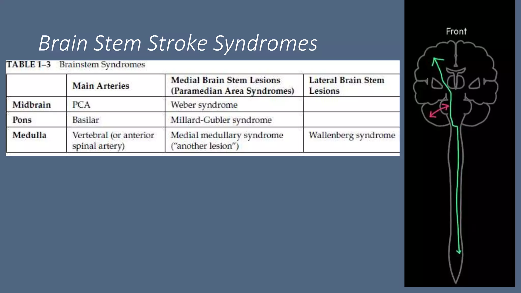 Stroke syndromes | PPTX