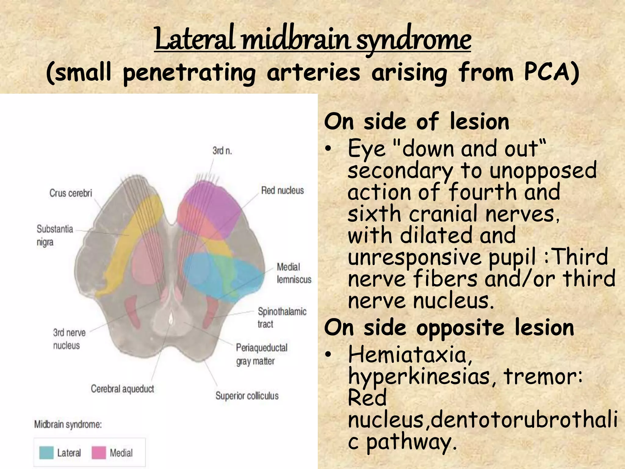 STROKE SYNDROMES.pptx