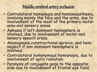 STROKE SYNDROMES.pptx