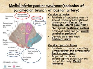 STROKE SYNDROMES.pptx