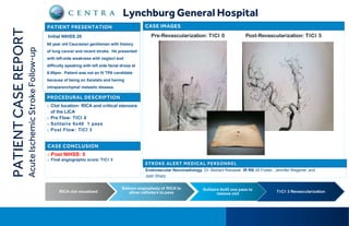 Stroke thrombectomy | PPT