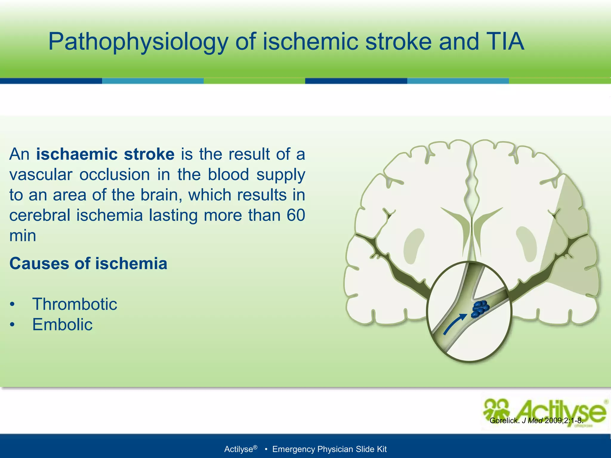 Stroke thrombolysis protocol | PPTX