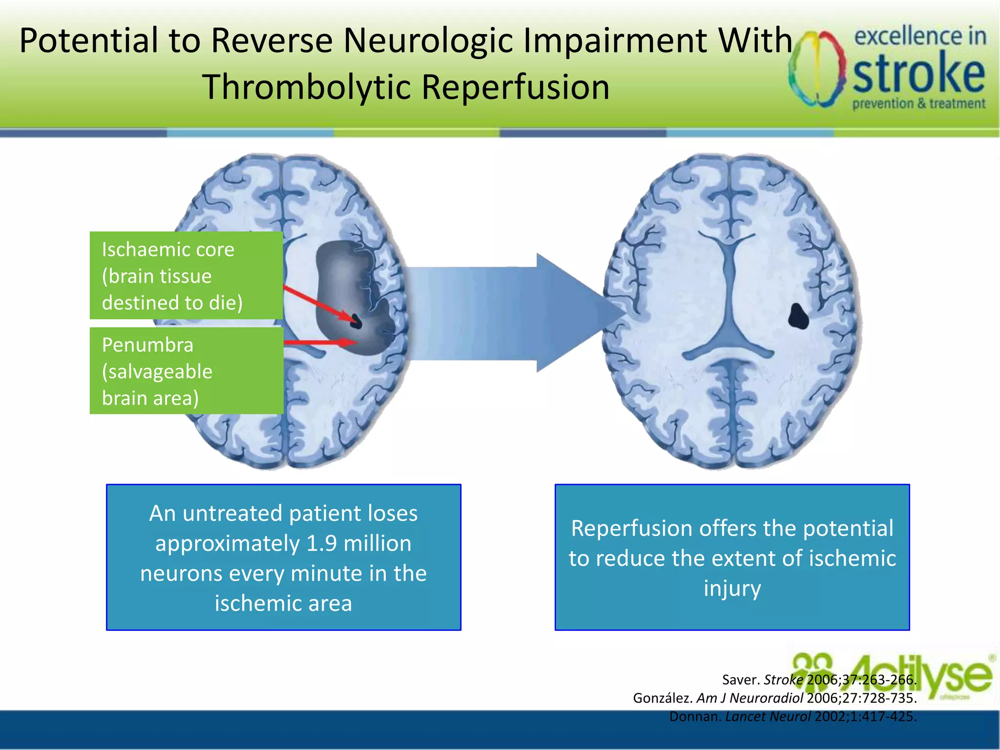 Stroke thrombolysis protocol | PPTX