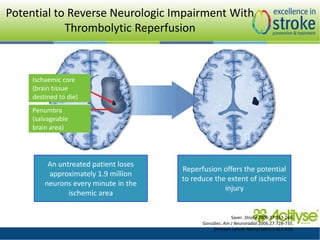 Stroke thrombolysis protocol | PPTX