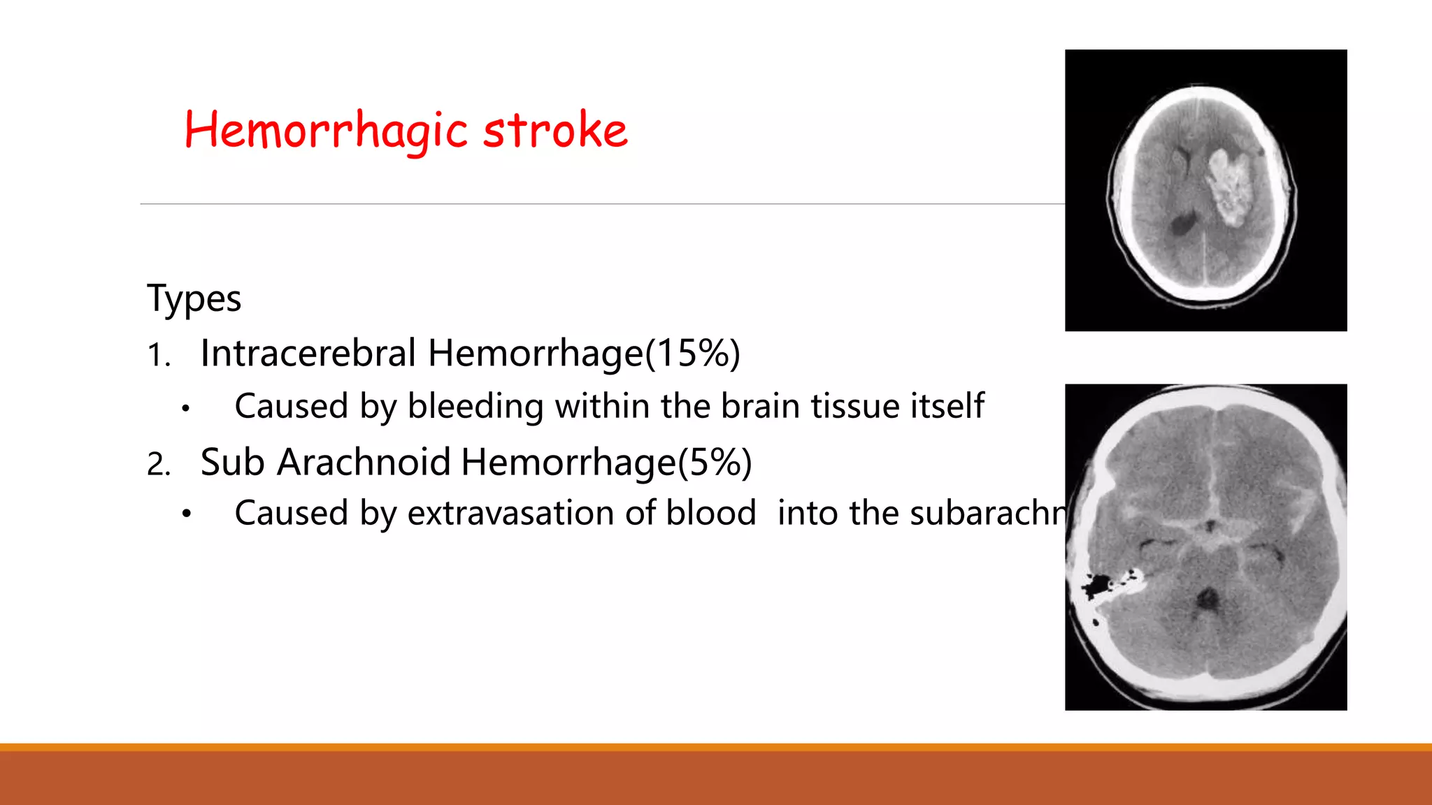 Stroke Treatment Protocol.pptx