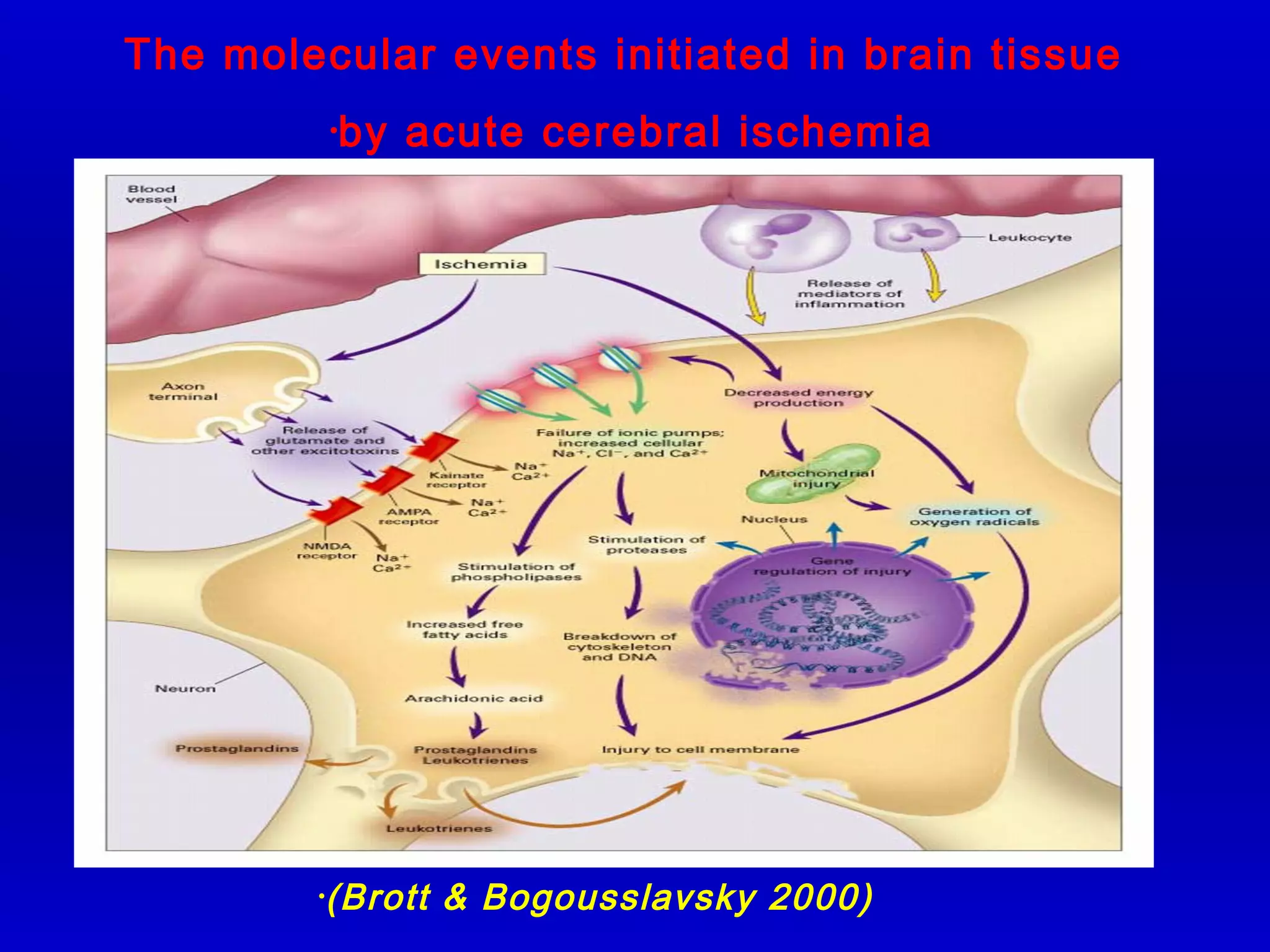 Stroke Basic Knowledge Bhs Indonesia | PPT