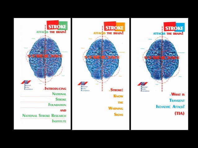 Stroke Basic Knowledge Bhs Indonesia | PPT