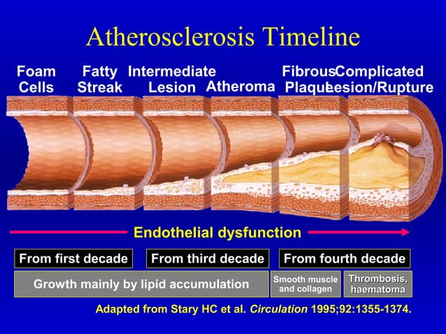 Stroke Basic Knowledge Bhs Indonesia | PPT