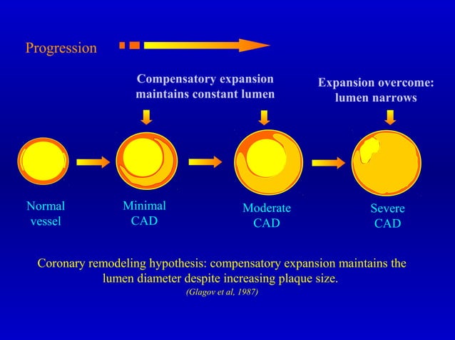 Stroke Basic Knowledge Bhs Indonesia | PPT