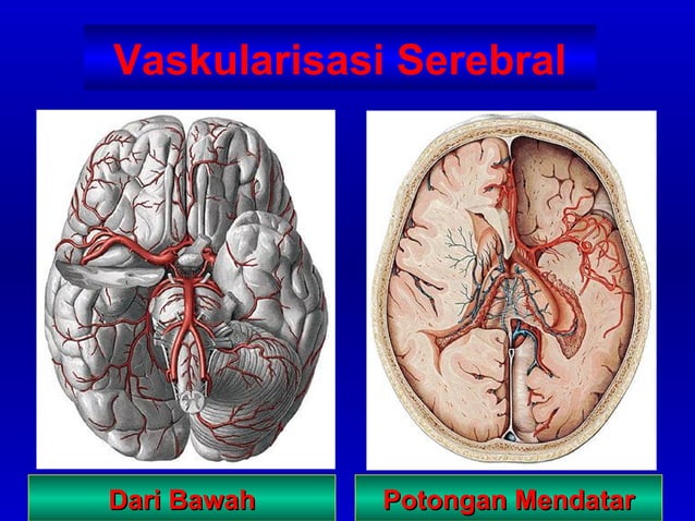Stroke Basic Knowledge Bhs Indonesia | PPT