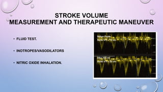 Stroke volume and cardiac output | PPTX