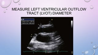 Stroke volume and cardiac output | PPTX