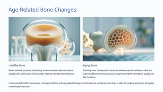 Strong Bones Made Simple: A Comprehensive Guide to Preventing ...