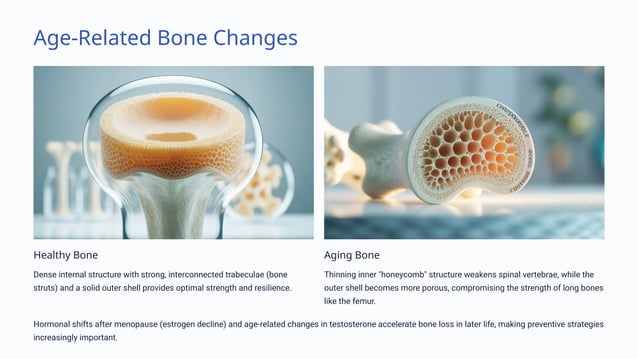 Strong Bones Made Simple: A Comprehensive Guide to Preventing ...