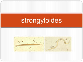 Strongyloides | PPTX