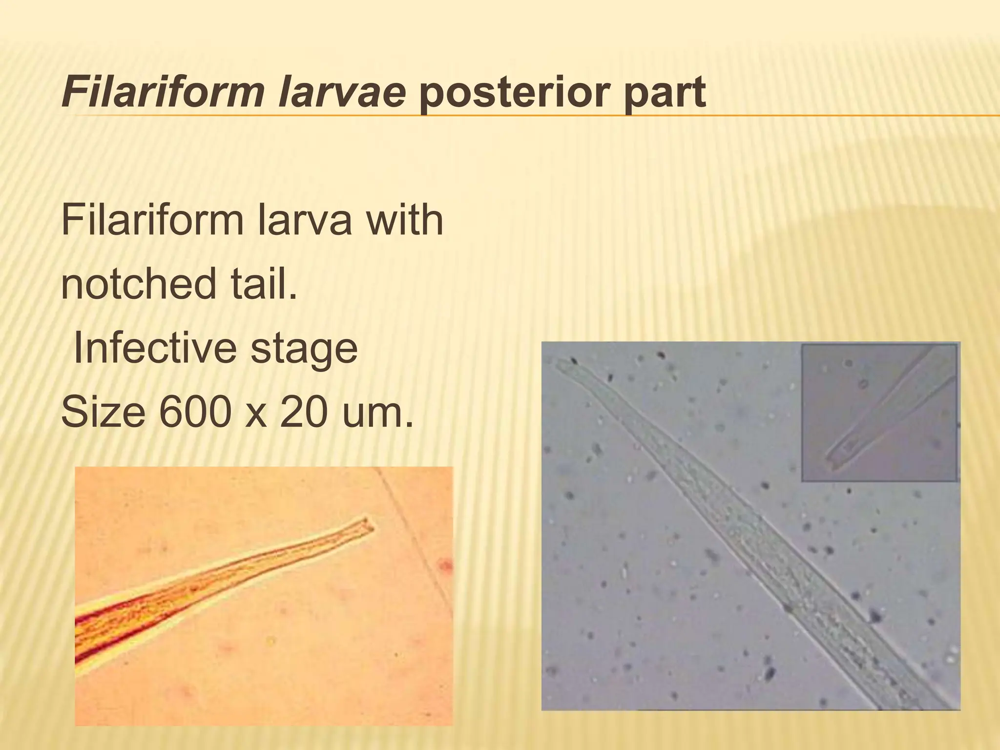 Powerpoint strongyloides stercoralis.ppt
