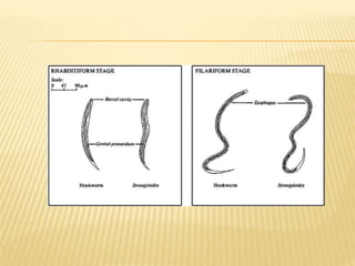Powerpoint strongyloides stercoralis.ppt