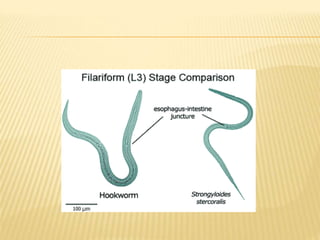Powerpoint strongyloides stercoralis.ppt