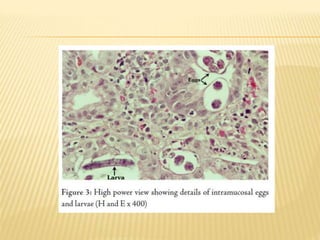 Powerpoint strongyloides stercoralis.ppt