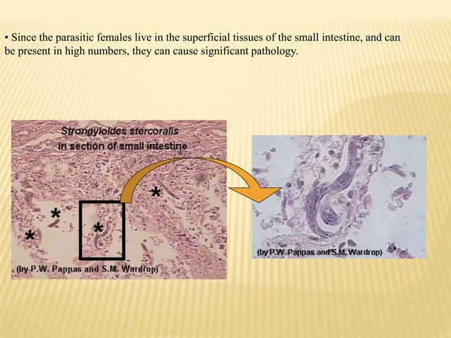 Powerpoint strongyloides stercoralis.ppt