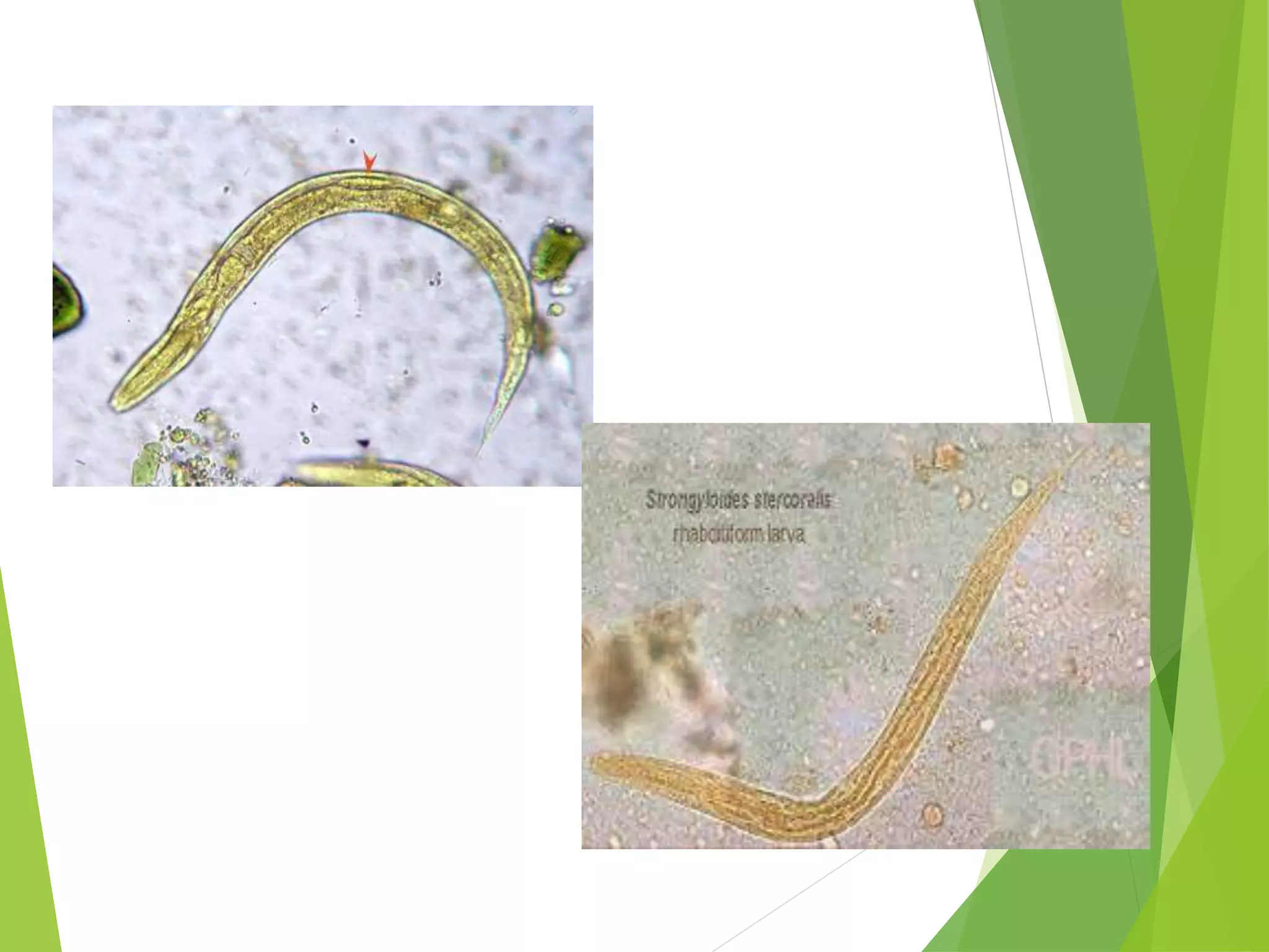 strongyloides-stercoralis.pptx