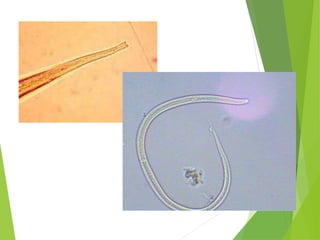 strongyloides-stercoralis.pptx