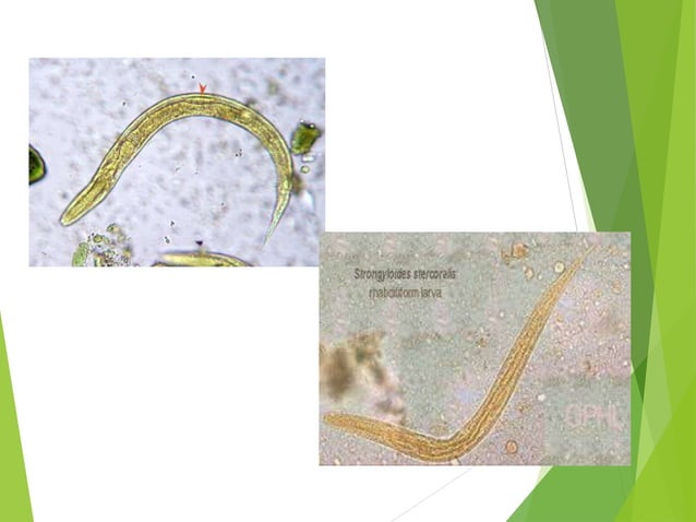 strongyloides-stercoralis.pptx