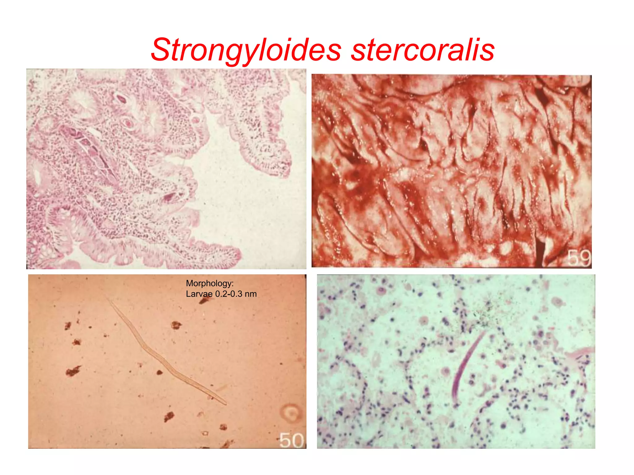 Strongyloides stercoralis | PPTX