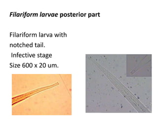 Strongyloides Stercoralis Filariform Larvae